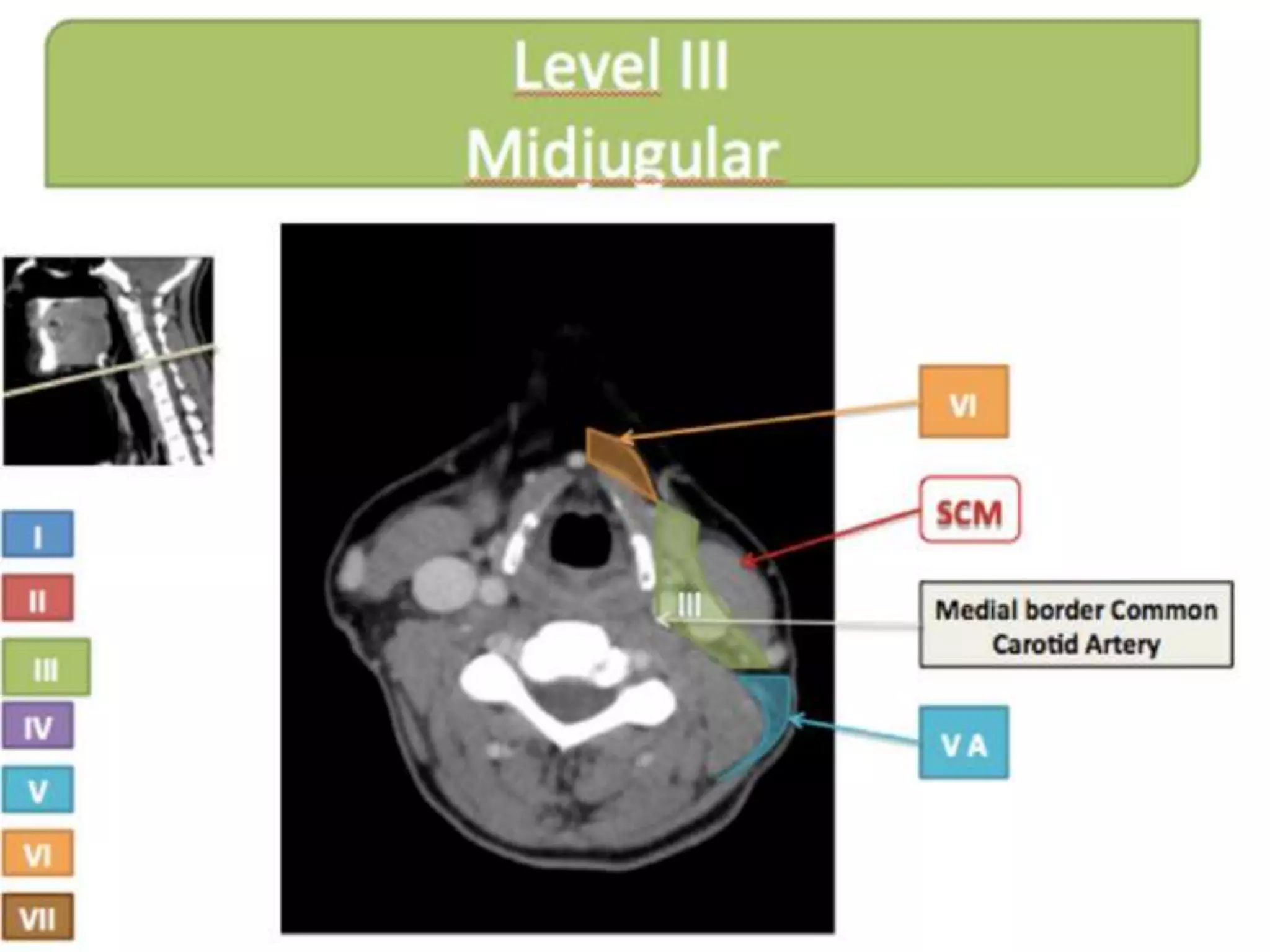 Levels of cervical nodes | PPT