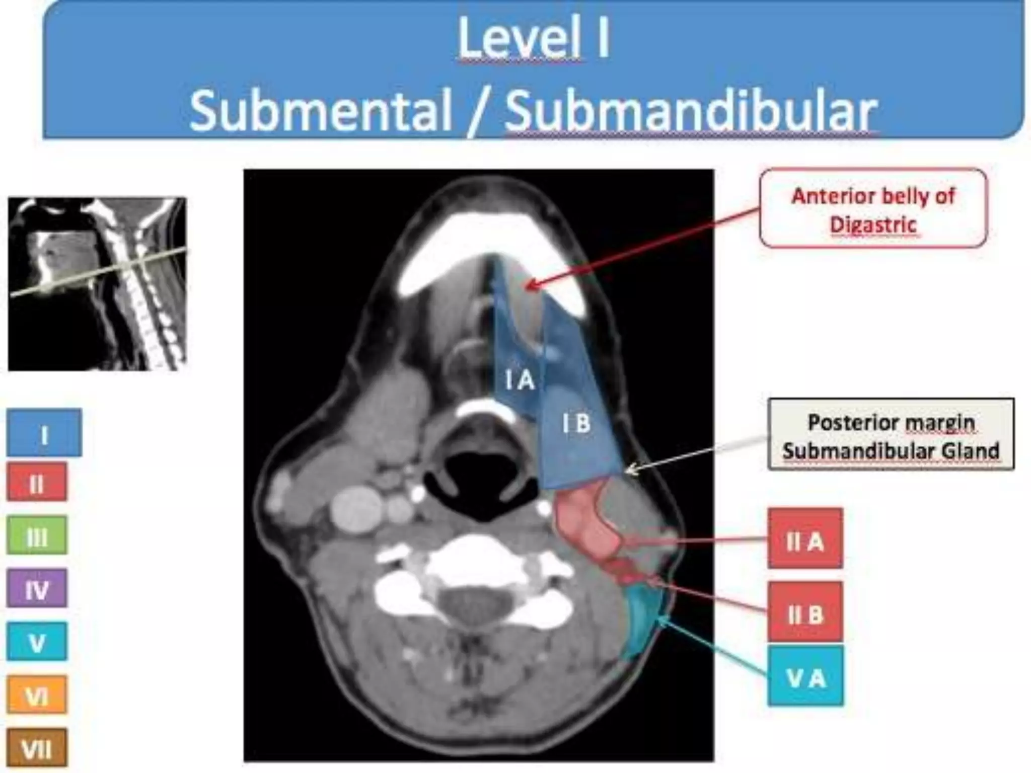 Levels of cervical nodes | PPT