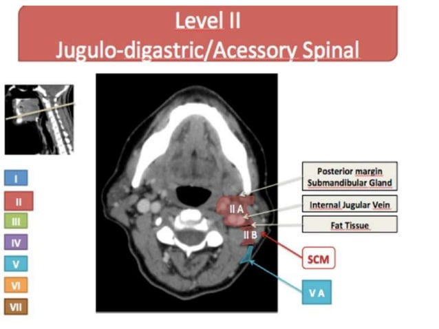 Levels of cervical nodes | PPTX
