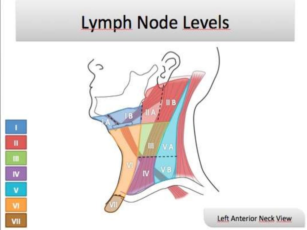 Levels of cervical nodes