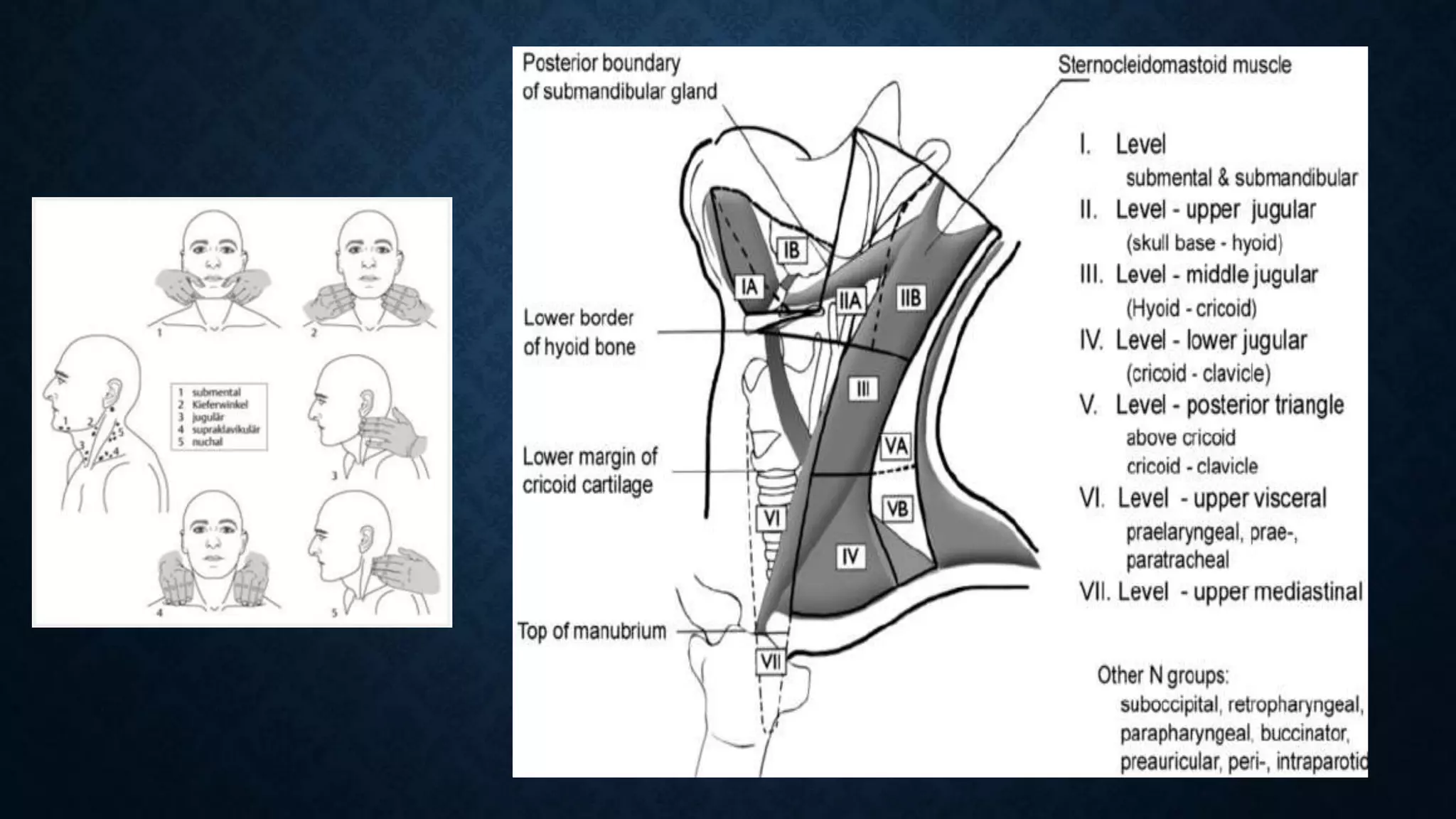 Levels of lymph nodes in head and neck | PPTX