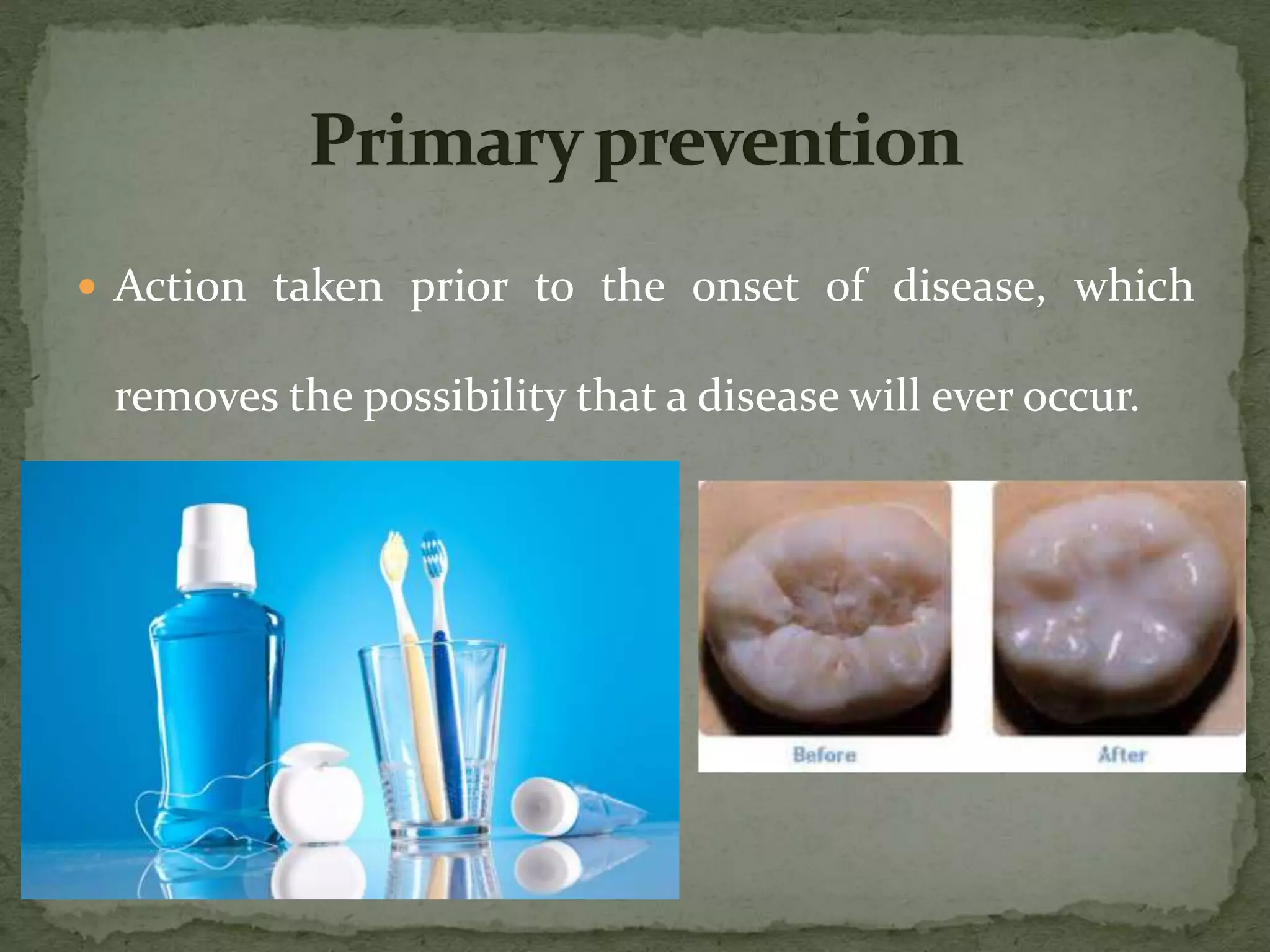 Levels of prevention | PPTX