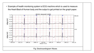 Leveraging Cloud Computing for ECG Analysis.pptx | Cloud Computing | Internet