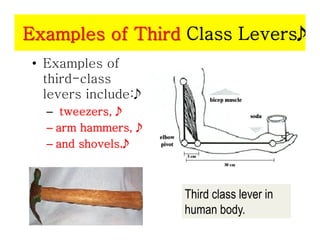 Third Class Lever Tweezers