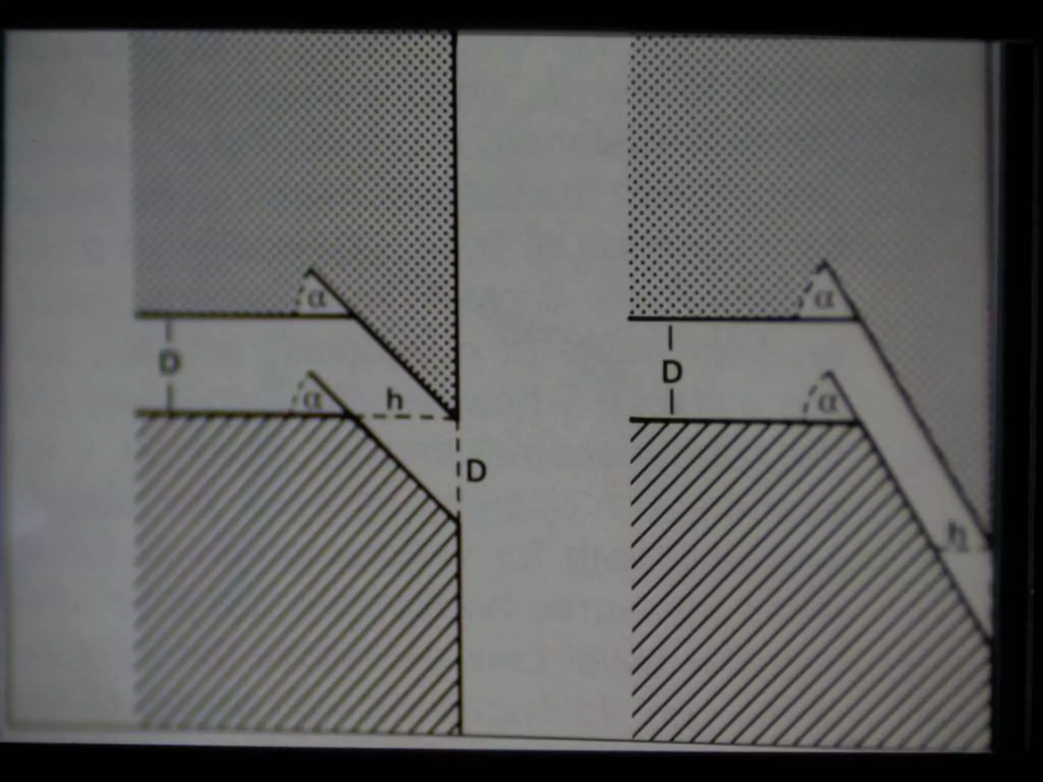 Preparation on Full Aesthetic Crown | PPTX