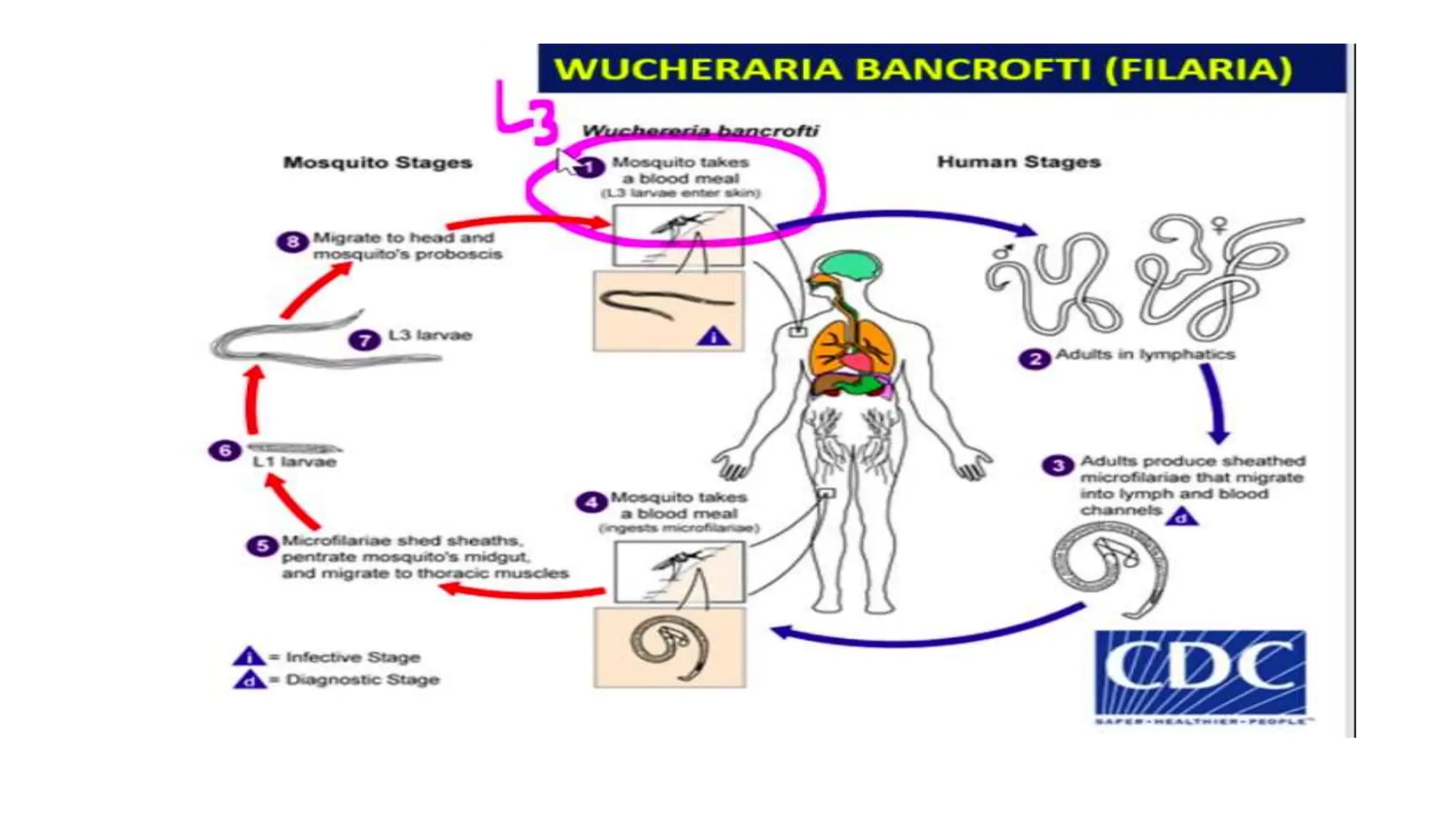 LF, Lymphatic Filariasis, PSM,COMMUNITY MEDICINE,DR NARENDRA KUMAR ...