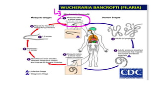 LF, Lymphatic Filariasis, PSM,COMMUNITY MEDICINE,DR NARENDRA KUMAR ...