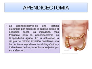 APENDICECTOMIA, causas, diagnósticoy tratamiento.pptx