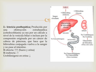 Sindrome Icterico | PPTX