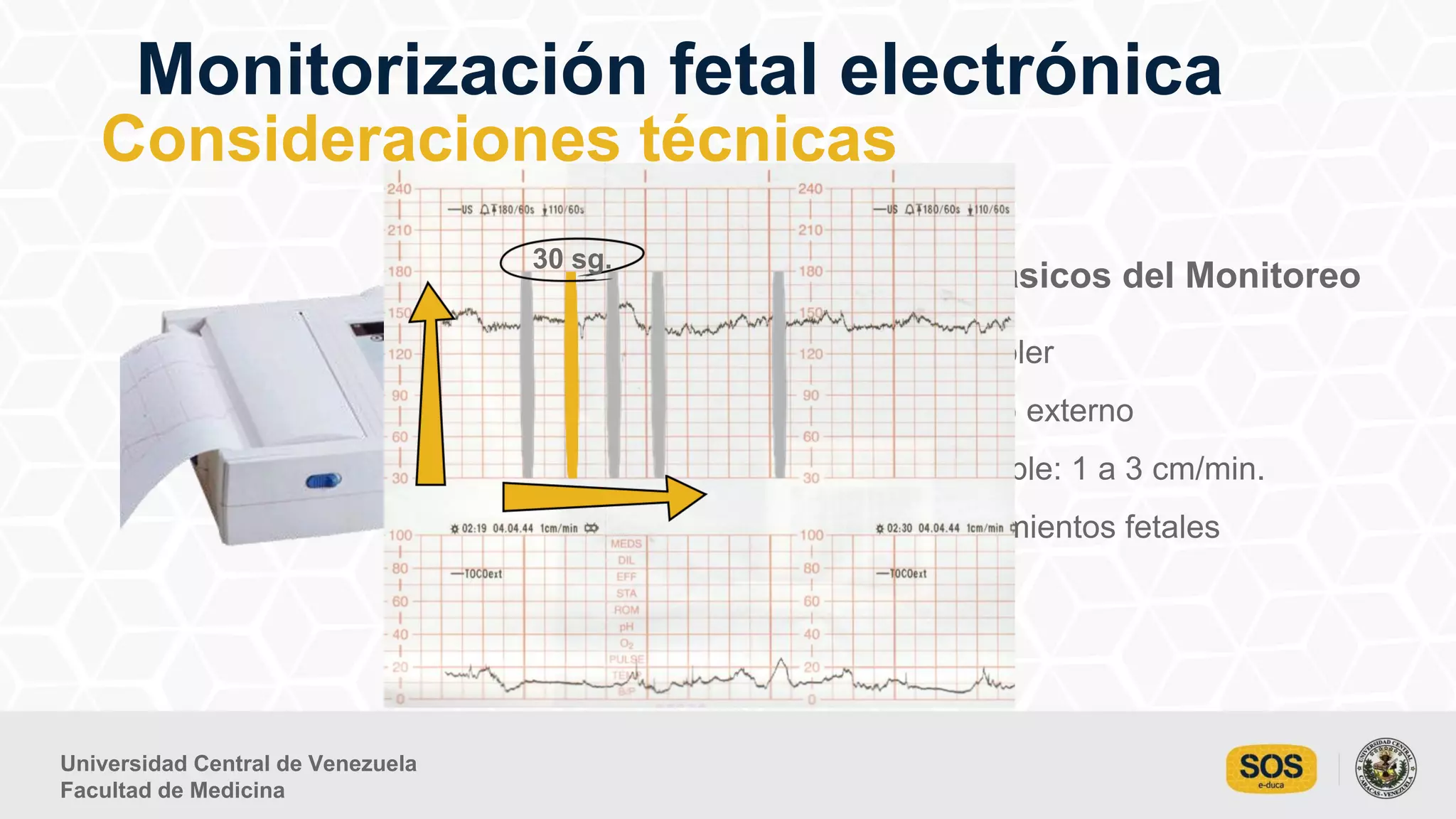 Evaluación de la salud fetal previa al nacimiento e identificación de ...