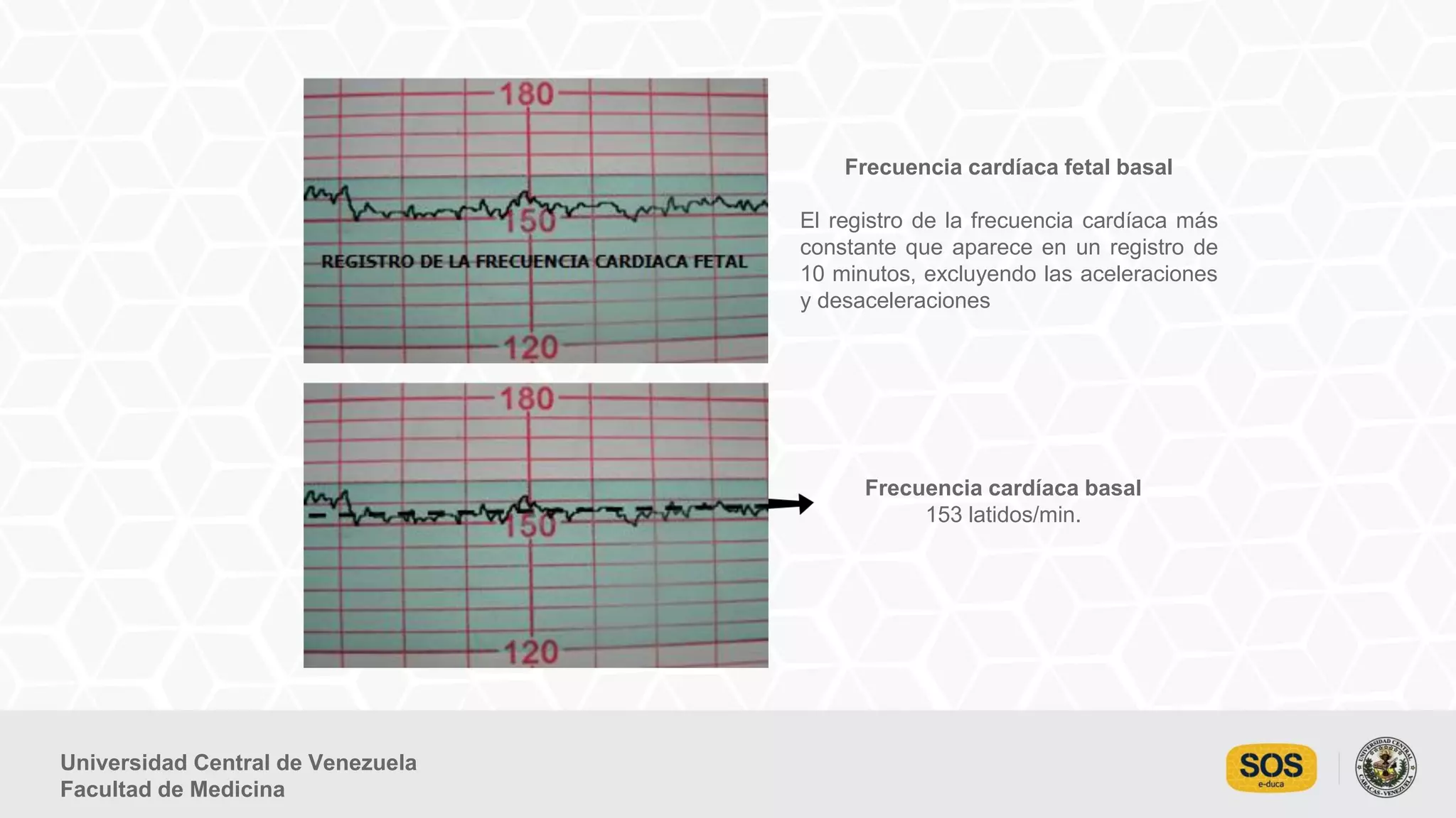 Evaluación de la salud fetal previa al nacimiento e identificación de ...