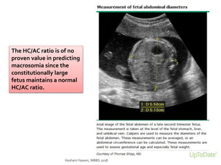 LGA seminar hashem 2018 | PPTX