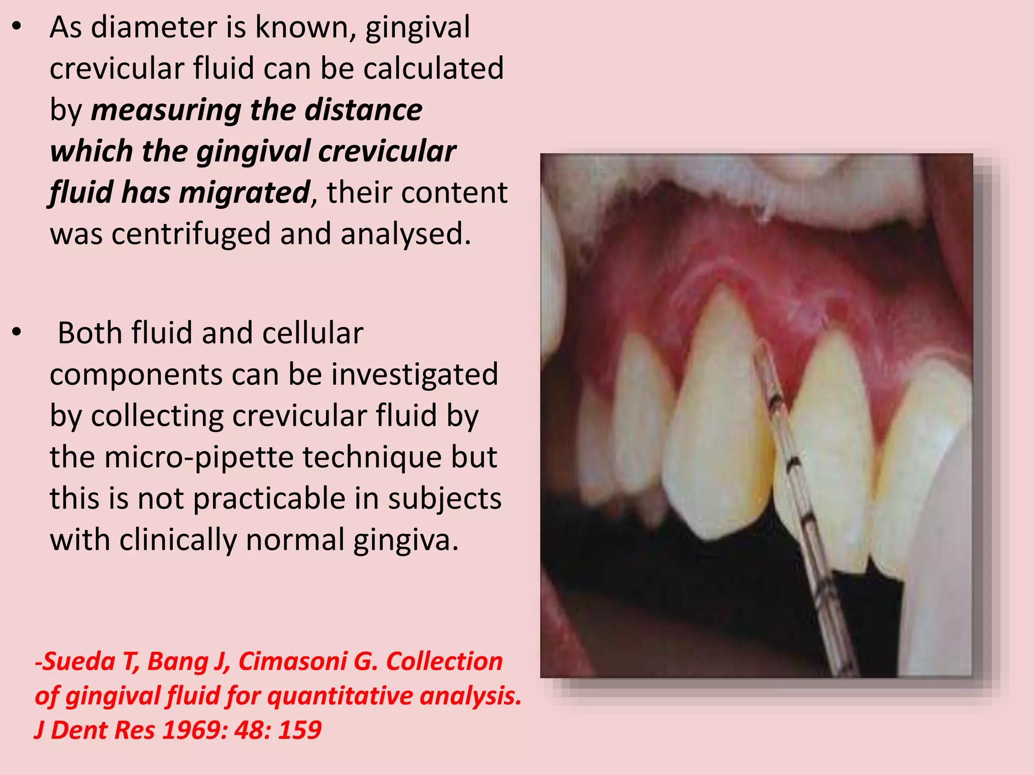 Gingival crevicular fluid | PPTX | Oral care | Personal Care