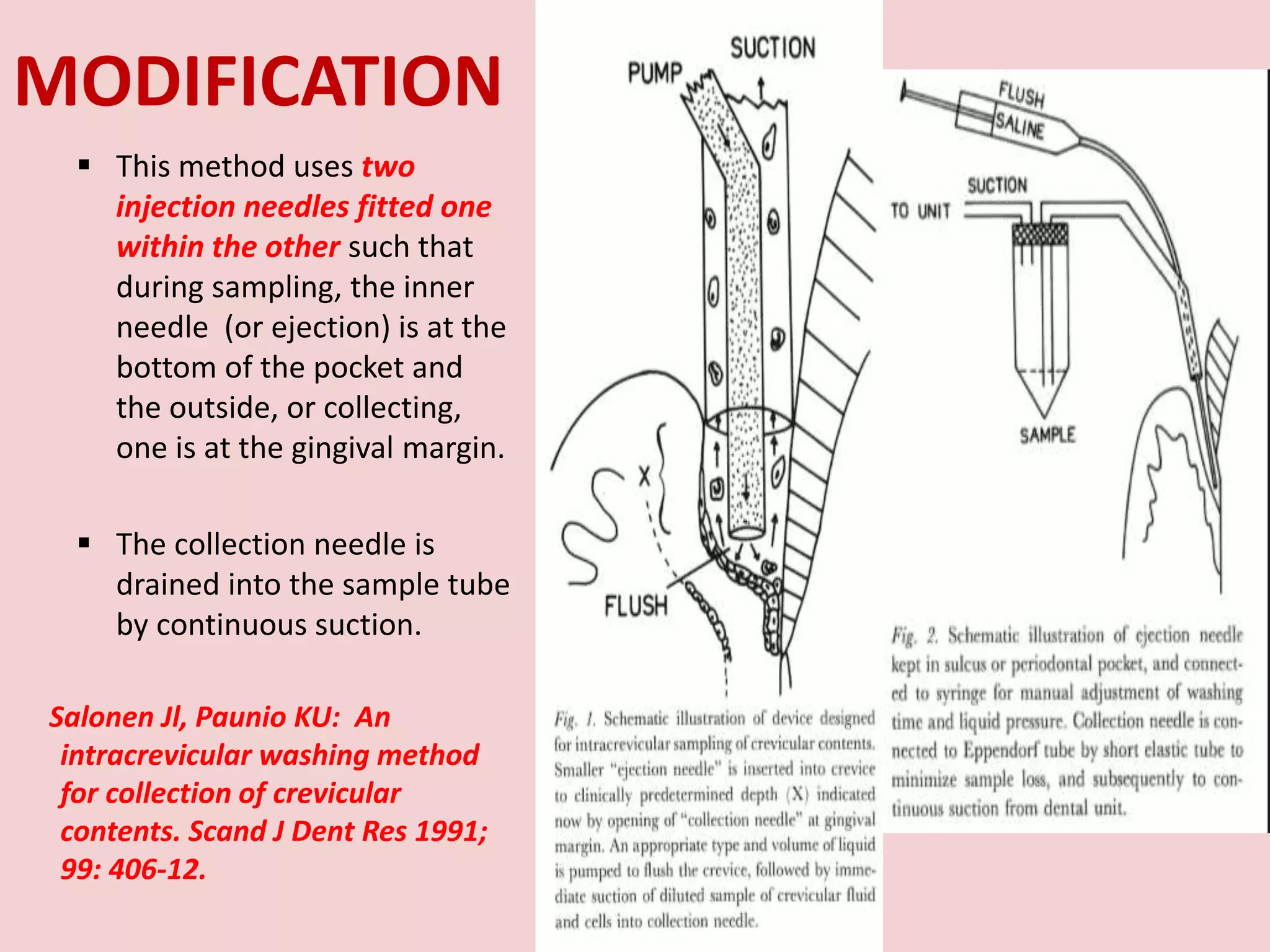 Gingival crevicular fluid | PPTX | Oral care | Personal Care