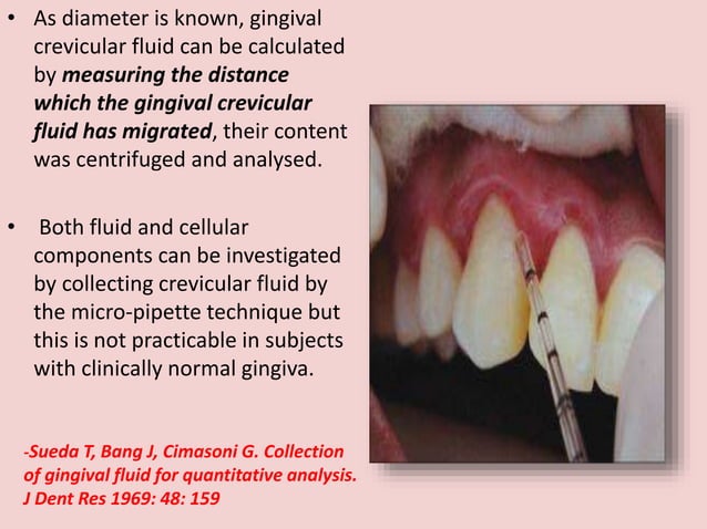 Gingival crevicular fluid | PPTX | Oral care | Personal Care
