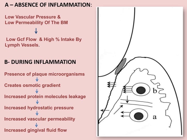 Gingival crevicular fluid | PPTX | Oral care | Personal Care