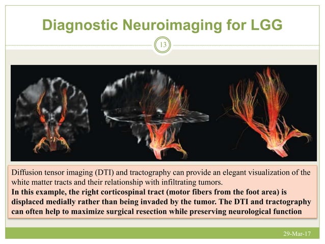 LOW GRADE GLIOMA controversies in management | PPTX