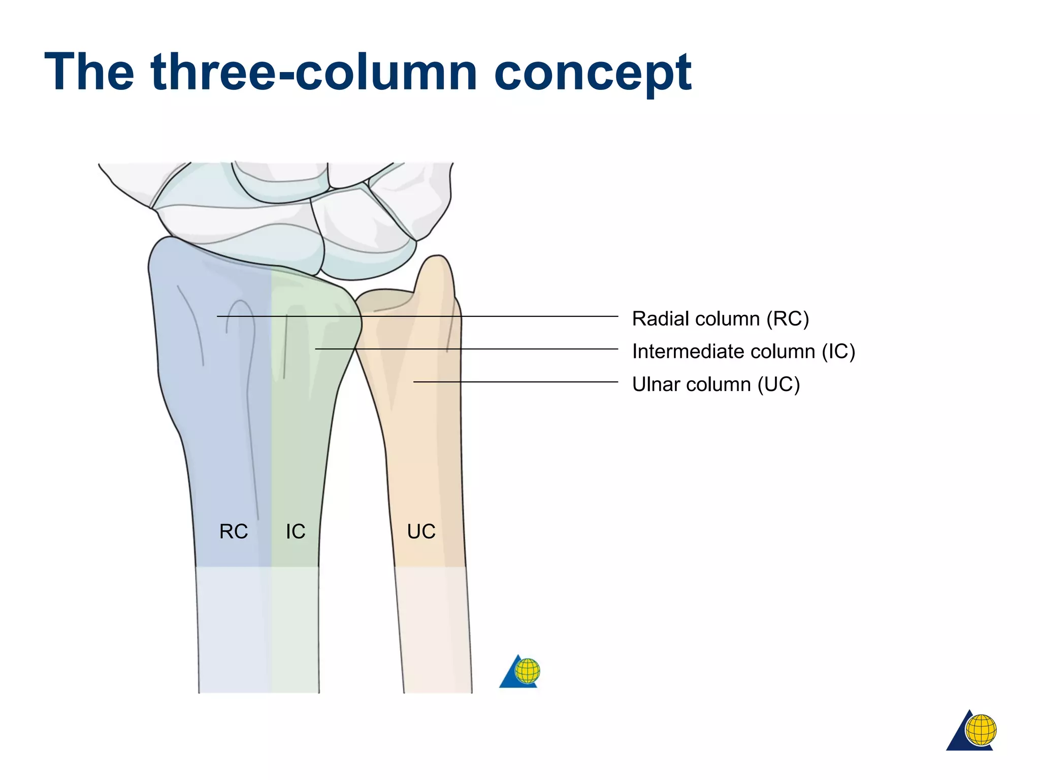 Distal radius | PPT