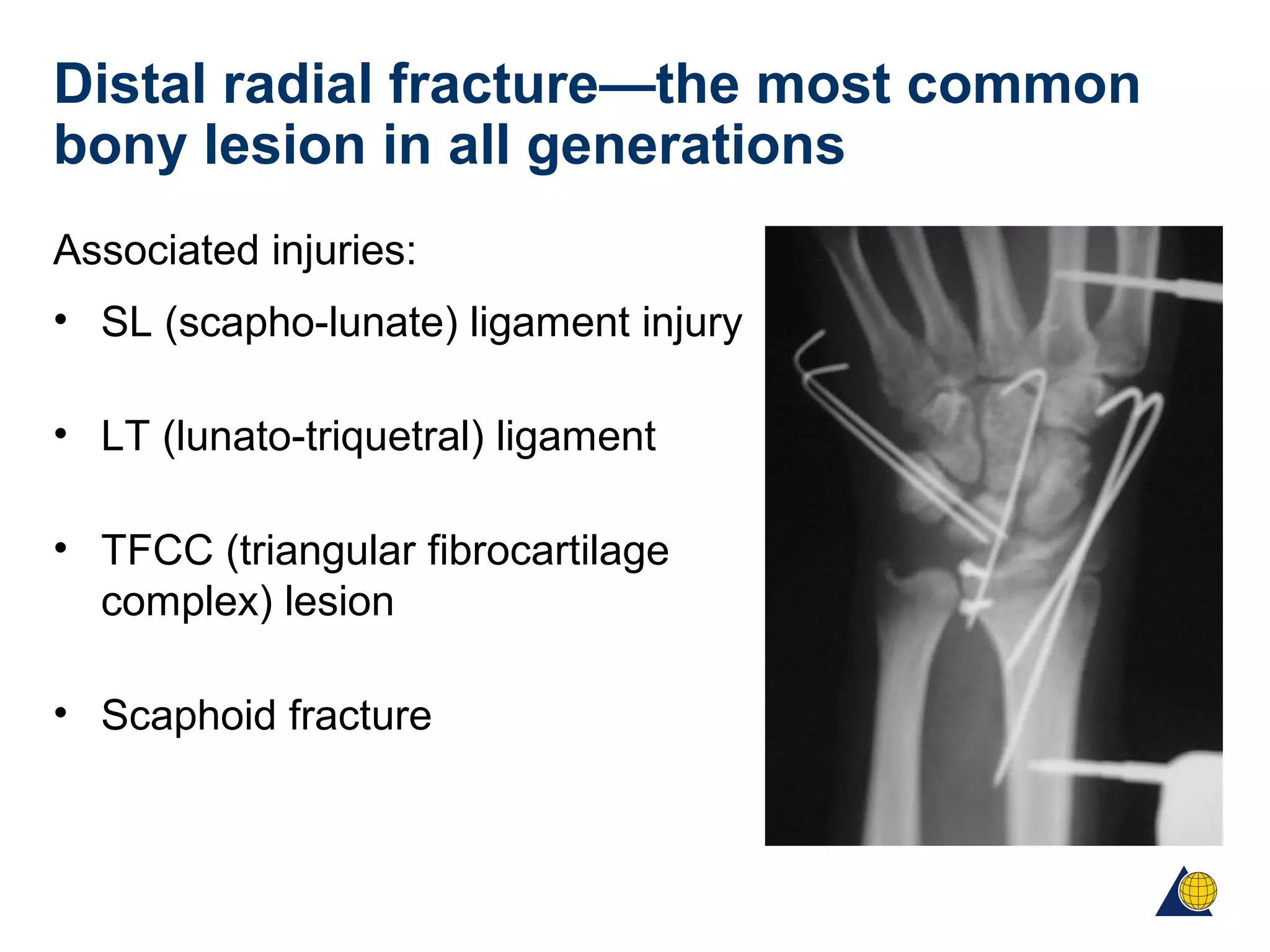 Distal radius | PPT