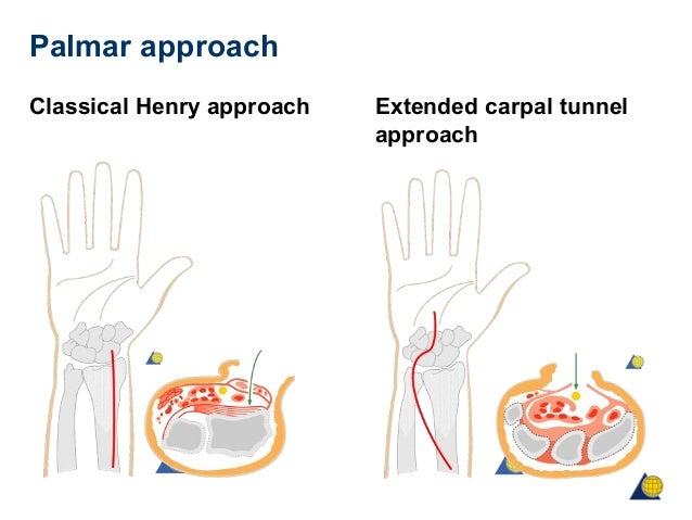 Distal radius