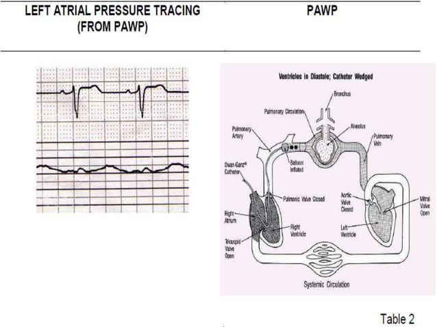 LEFT HEART CATHETERIZATION | PPTX | First Aid | Injuries