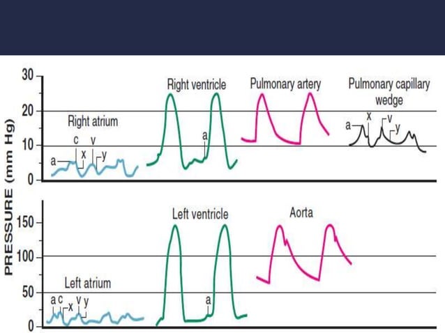 LEFT HEART CATHETERIZATION | PPTX | First Aid | Injuries