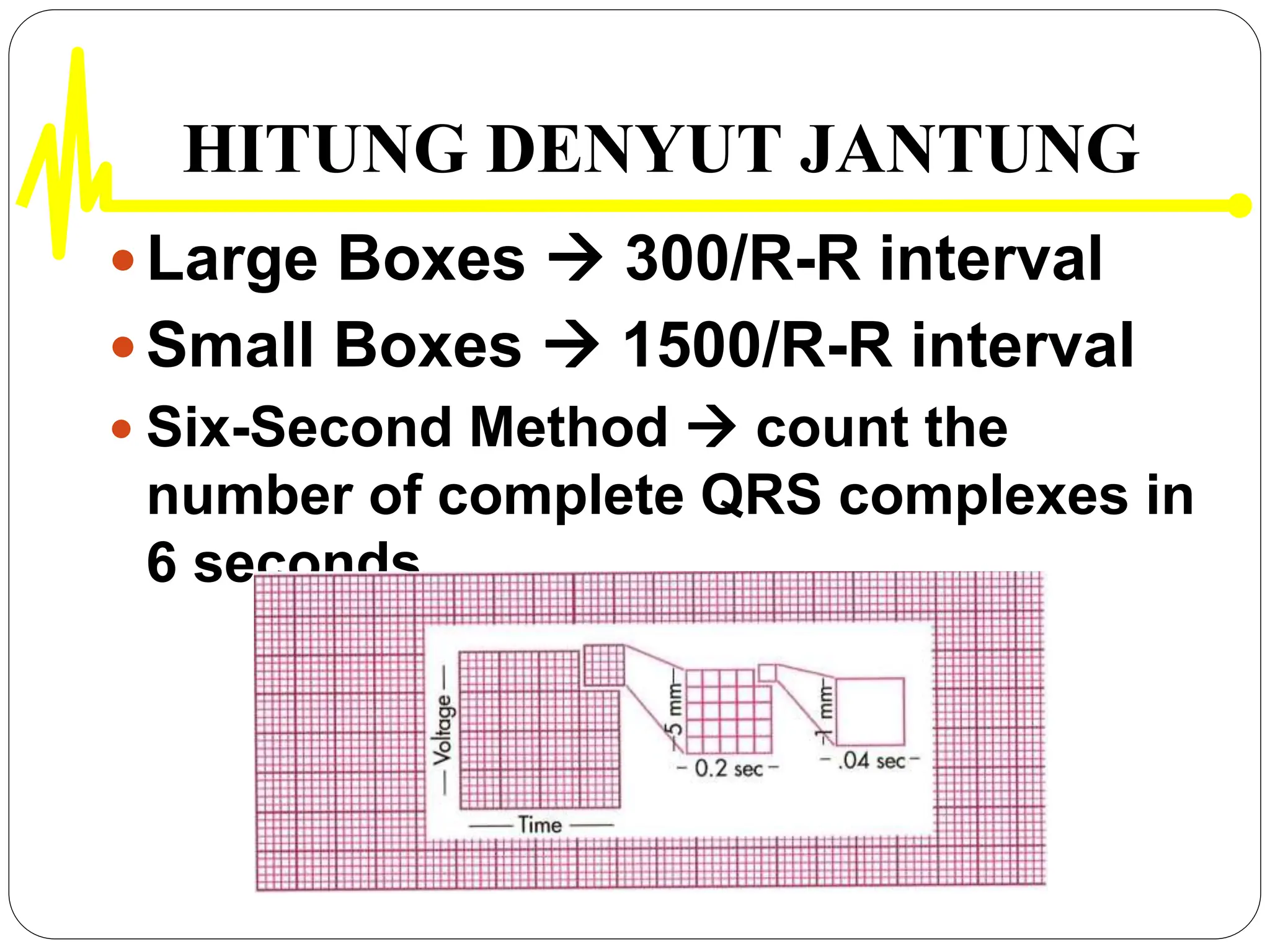 pembacaan dan interpreatsi ekg (cardio).ppt