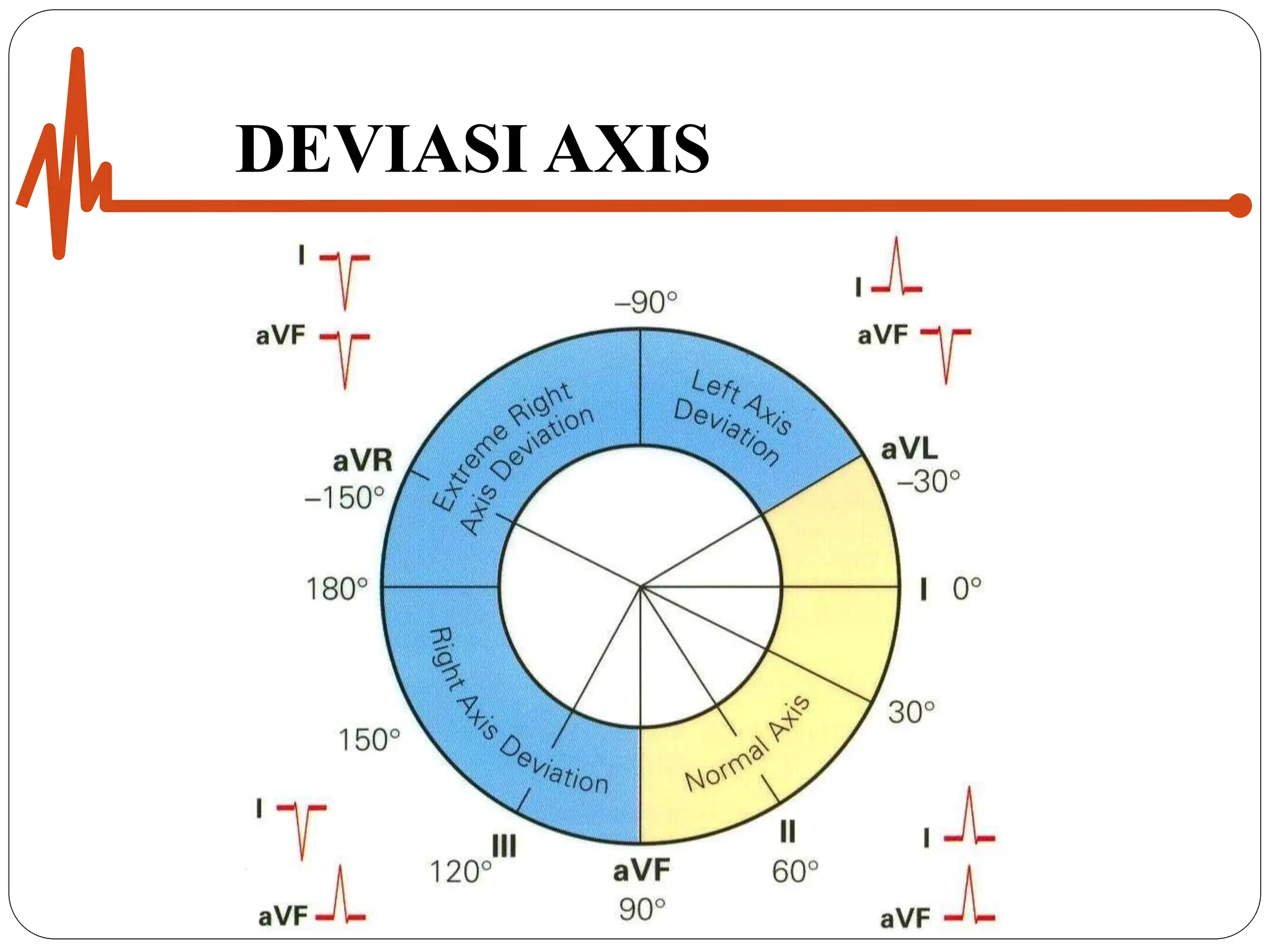 pembacaan dan interpreatsi ekg (cardio).ppt