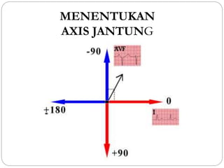 pembacaan dan interpreatsi ekg (cardio).ppt