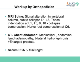 LHRH agonist vs antagonist in prostate cancer | PPT