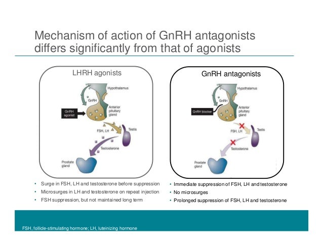LHRH agonist vs antagonist in prostate cancer