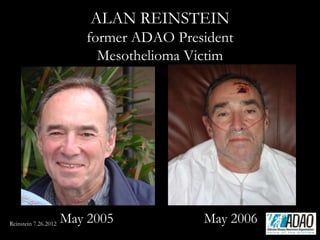 Reinstein: "Asbestos: The Cost in Dollars and Lives” | PPT