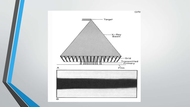 Filters used in radiology.ppt.radiology. | PPTX | Chemistry | Science