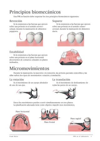 protesis parcial removible | PDF