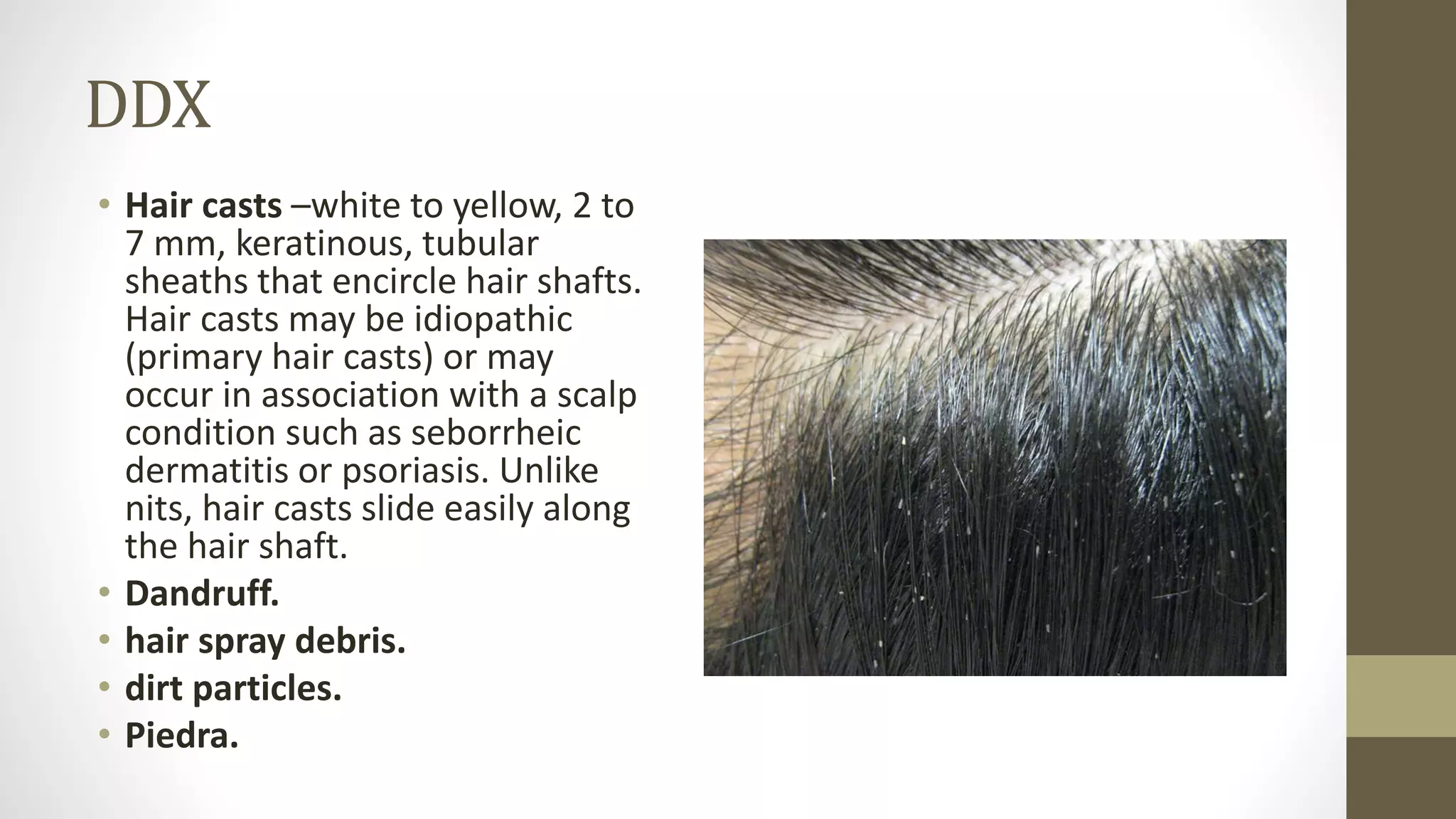 Lice | PPTX