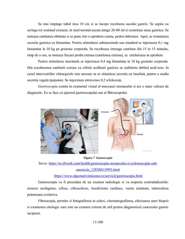 ROLUL ASISTENTULUI MEDICAL ȊN ȊNGRIJIREA PACIENTULUI CU ULCER GASTRO ...