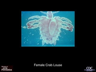 Lice & Scabies | PPT
