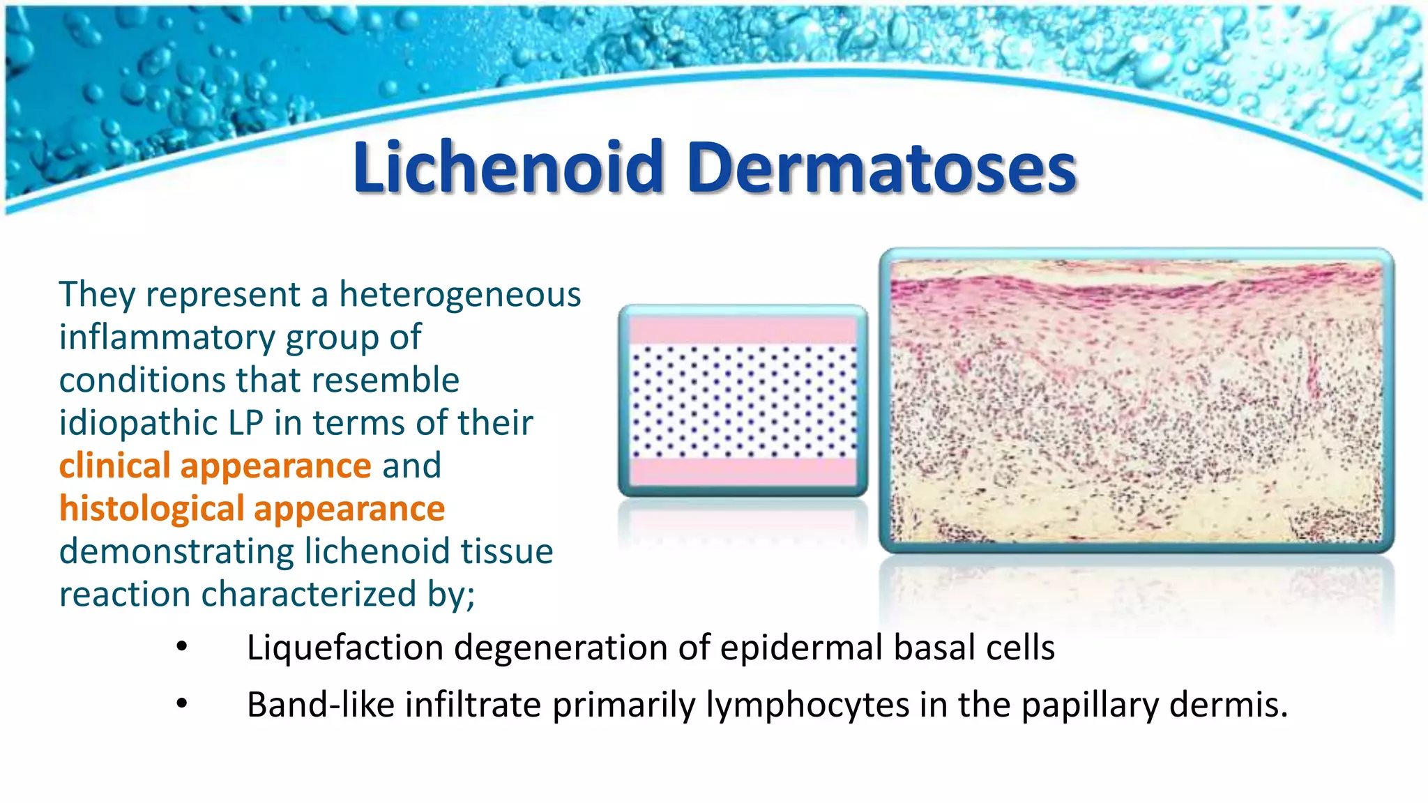 Lichenoid dermatoses.potx