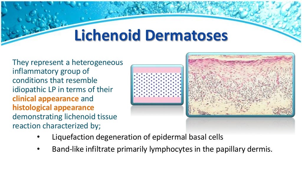 Lichenoid dermatoses.potx