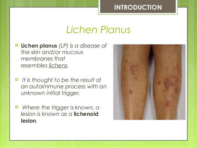 Lichen Planus Causes
