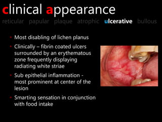 Oral Lichen Planus | PPTX