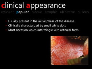 Oral Lichen Planus | PPTX