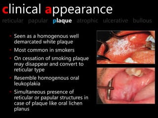 Oral Lichen Planus | PPTX