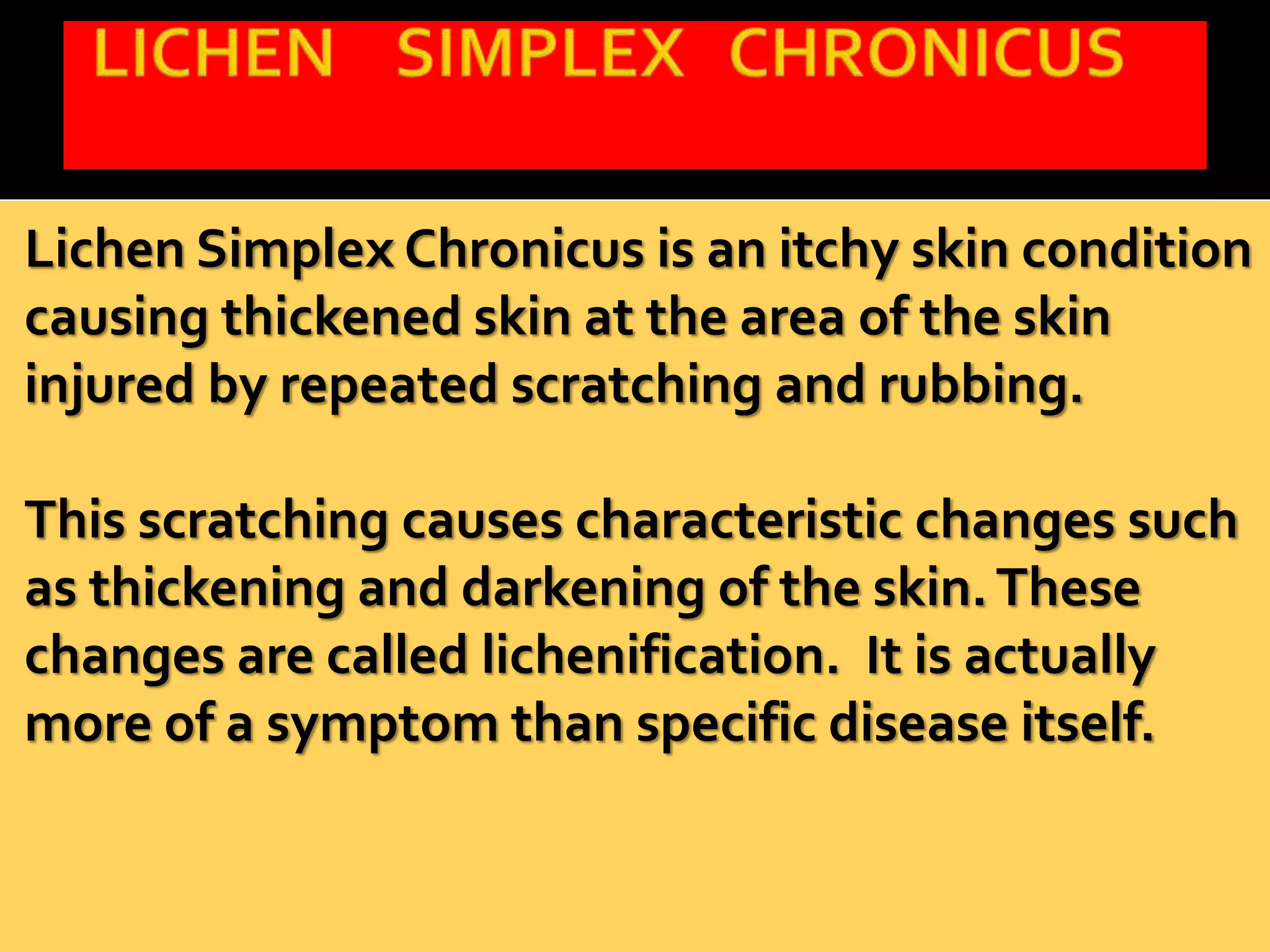 Ayurvedic Treatment for Lichen Planus , PLEVA , Lichen Simplex , LPP ...