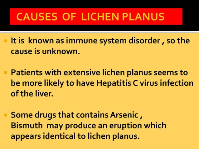 Ayurvedic Treatment for Lichen Planus , PLEVA , Lichen Simplex , LPP ...