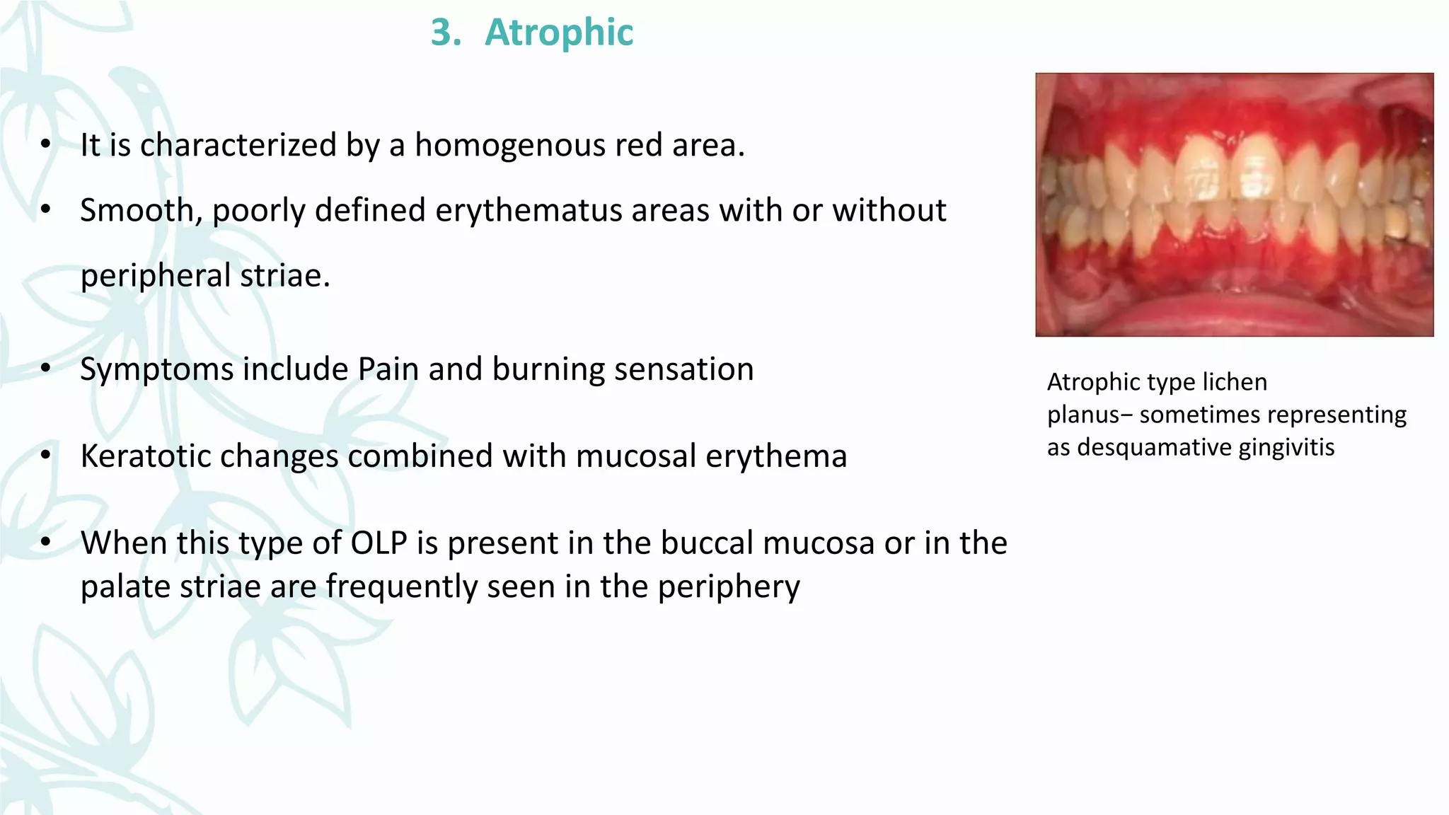 Lichen planus | PPTX