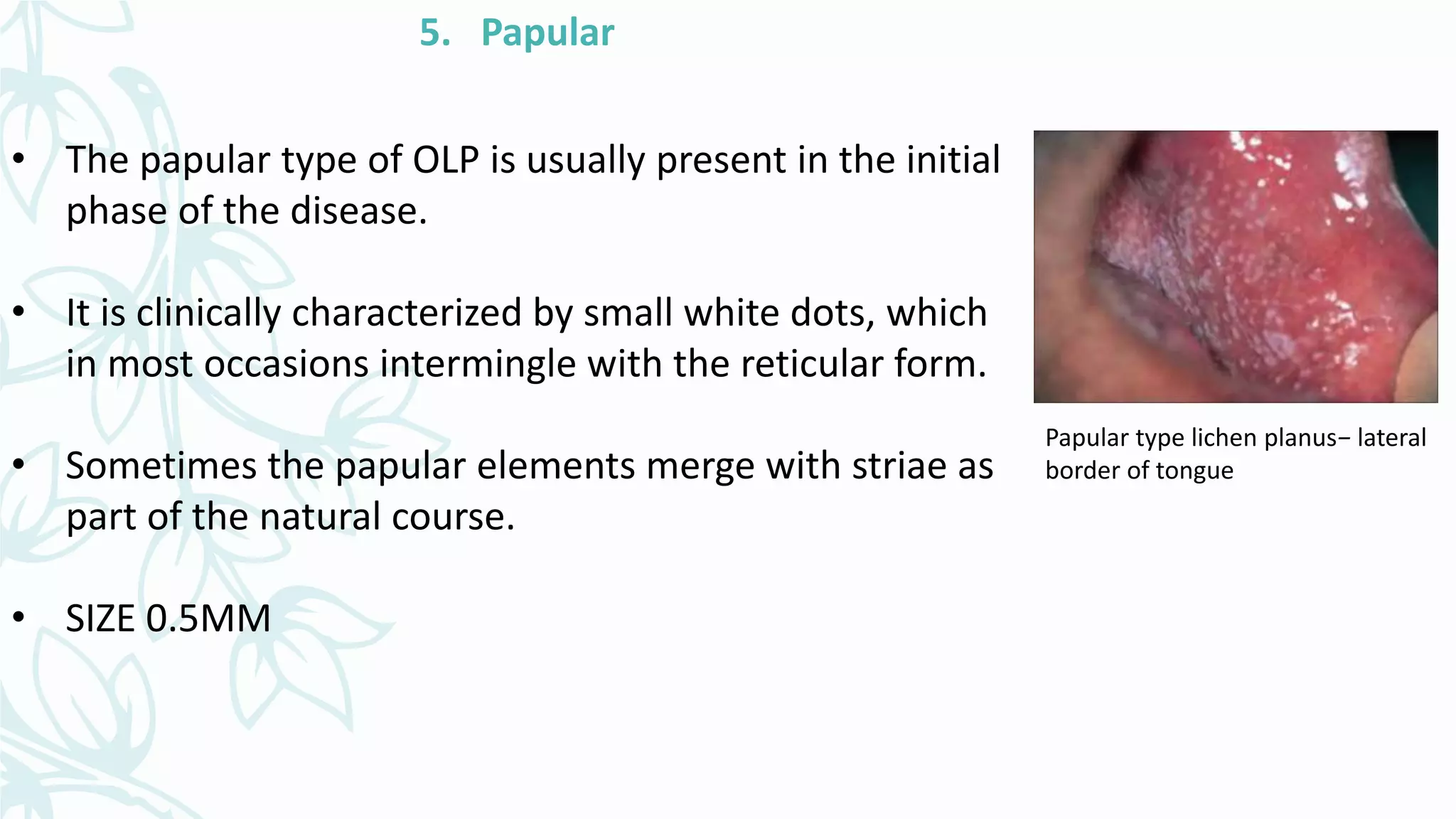 Lichen planus | PPTX