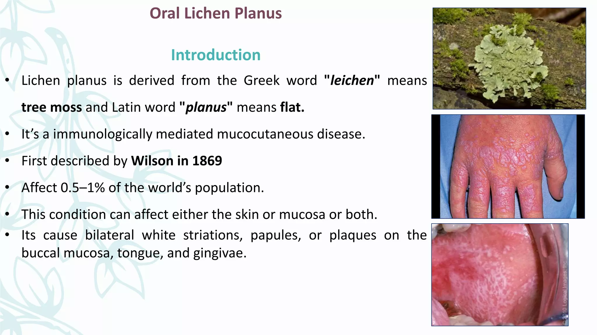 Lichen planus | PPTX