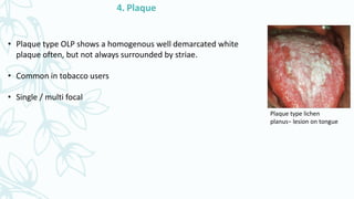 Lichen planus | PPTX