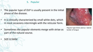Lichen planus | PPTX